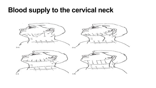 Neck Dissection Head Neck oncoSurgery.pptx | Death, Injury, or Military ...