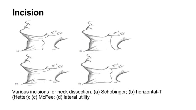 Neck Dissection Head Neck oncoSurgery.pptx | Death, Injury, or Military ...