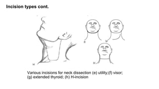 Neck Dissection Head Neck oncoSurgery.pptx
