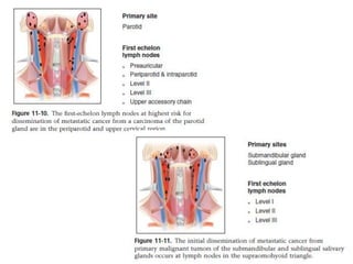 NECK DISSECTION-final (1).pptx Oral squamous cell carcinoma | PPTX