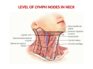 NECK DISSECTION-final (1).pptx Oral squamous cell carcinoma | PPTX