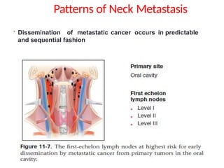 NECK DISSECTION-final (1).pptx Oral squamous cell carcinoma | PPTX