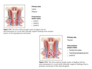 NECK DISSECTION-final (1).pptx Oral squamous cell carcinoma | PPTX