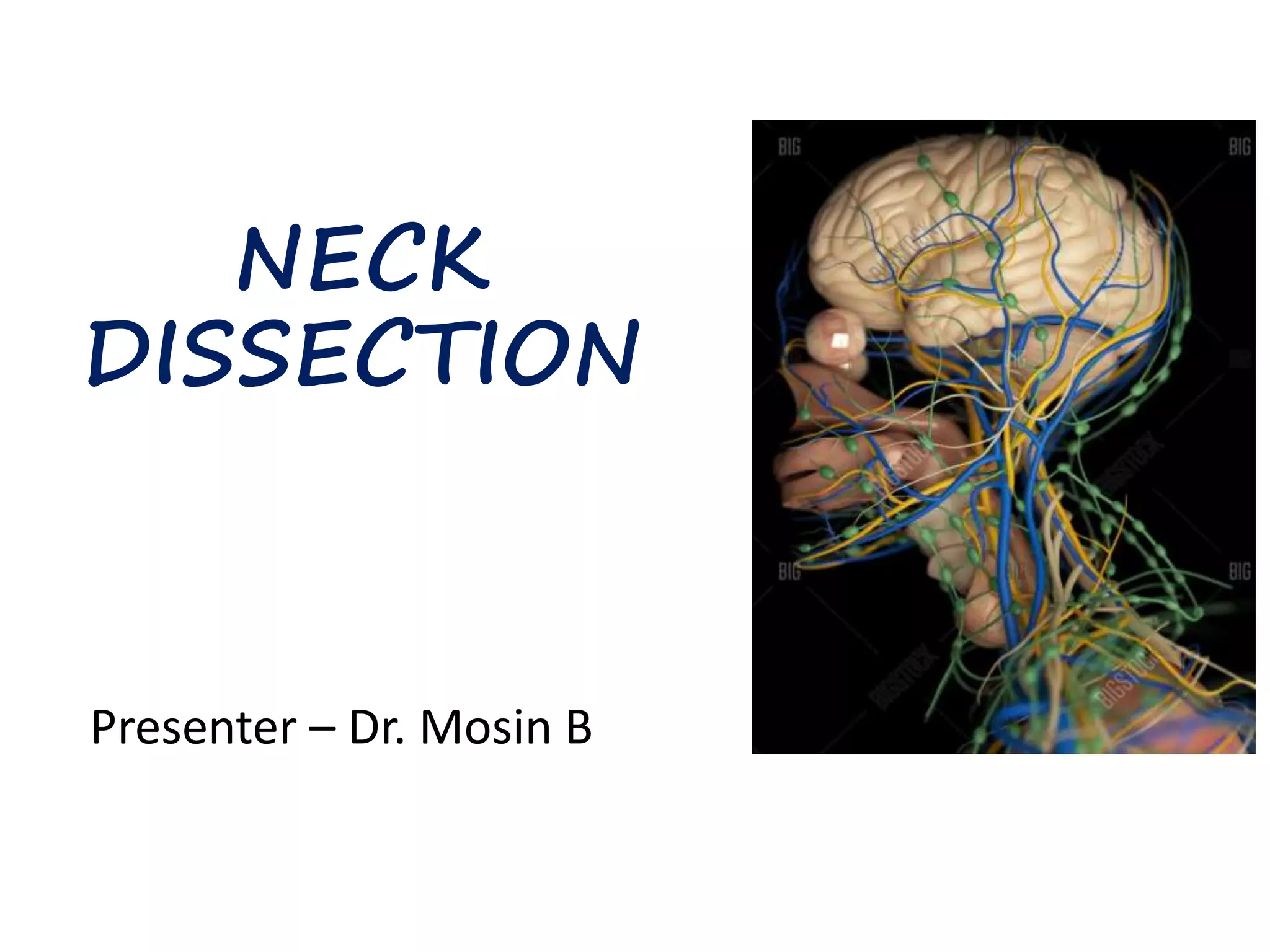 Neck dissection | PPTX