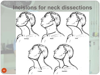 Neck dissection by dr akash rajput | PPTX