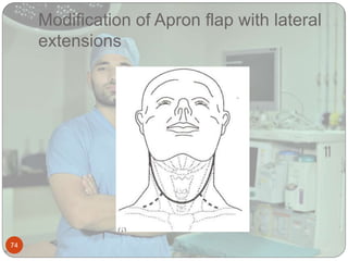Neck dissection by dr akash rajput | PPTX