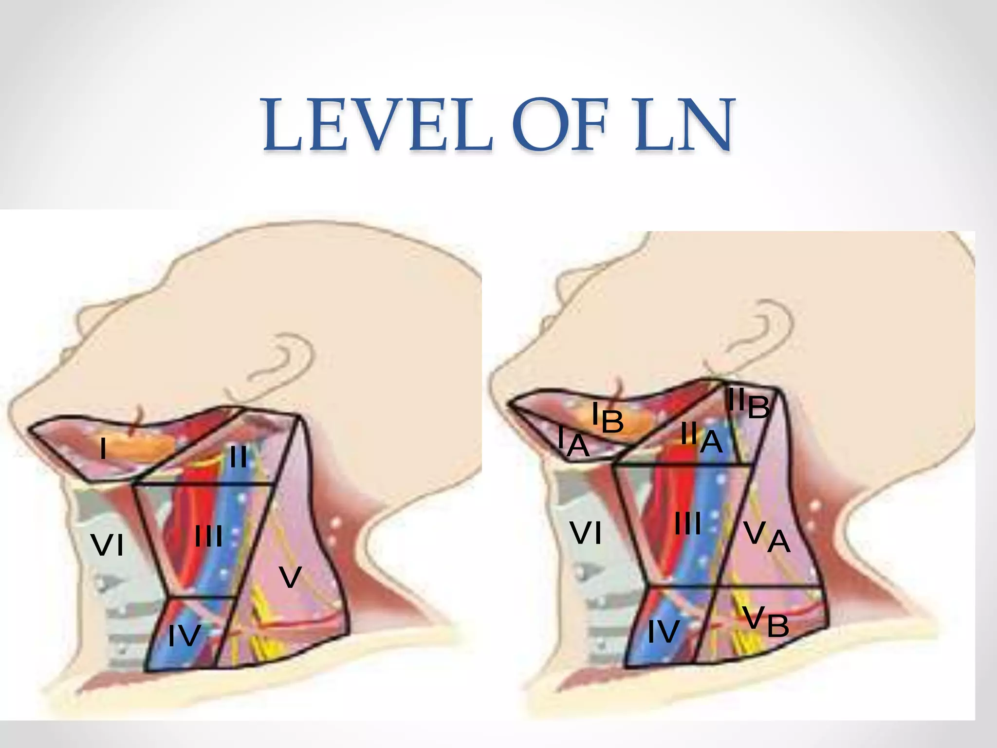 Neck dissection & local flap IN HNSCC | PPT