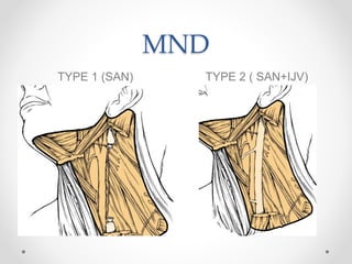 Neck dissection & local flap IN HNSCC | PPTX