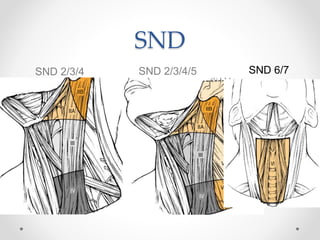 Neck dissection & local flap IN HNSCC | PPTX