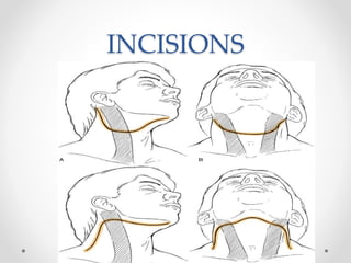Neck dissection & local flap IN HNSCC | PPTX