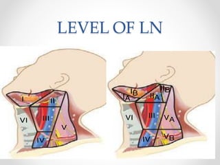 Neck dissection & local flap IN HNSCC | PPTX