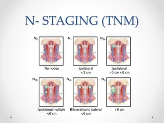 Neck dissection & local flap IN HNSCC | PPTX