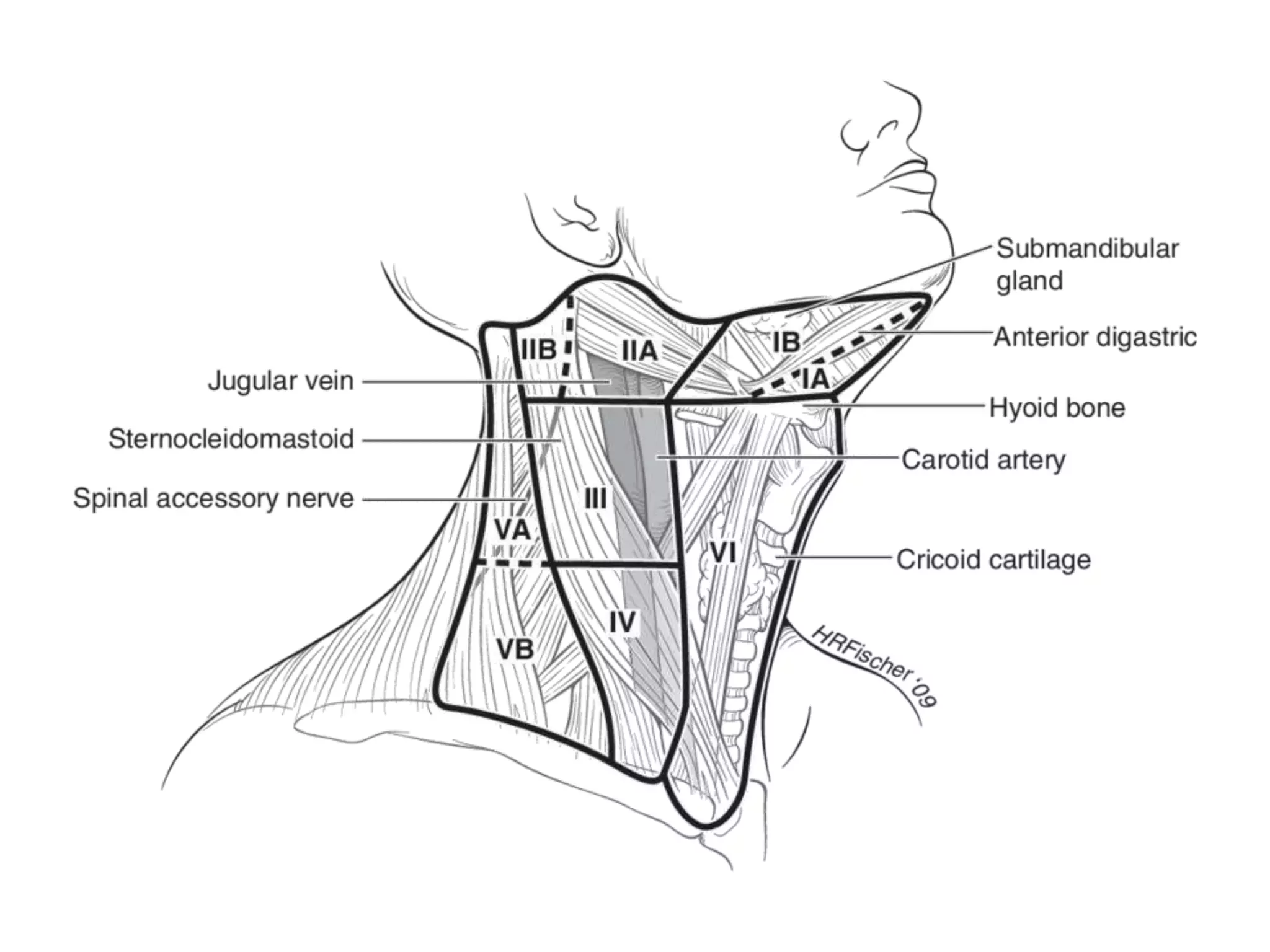 Neck dissection procedure | PPTX