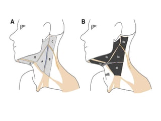 Neck dissection procedure | PPTX