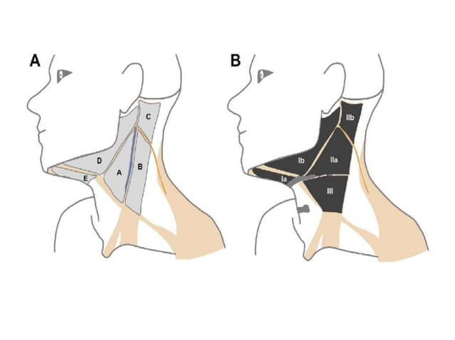 Neck dissection procedure | PPTX