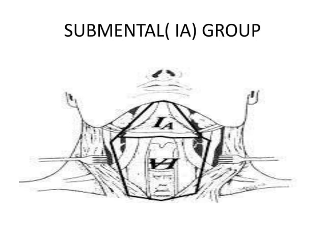 Neck dissection procedure | PPTX