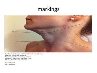 Neck dissection procedure | PPTX