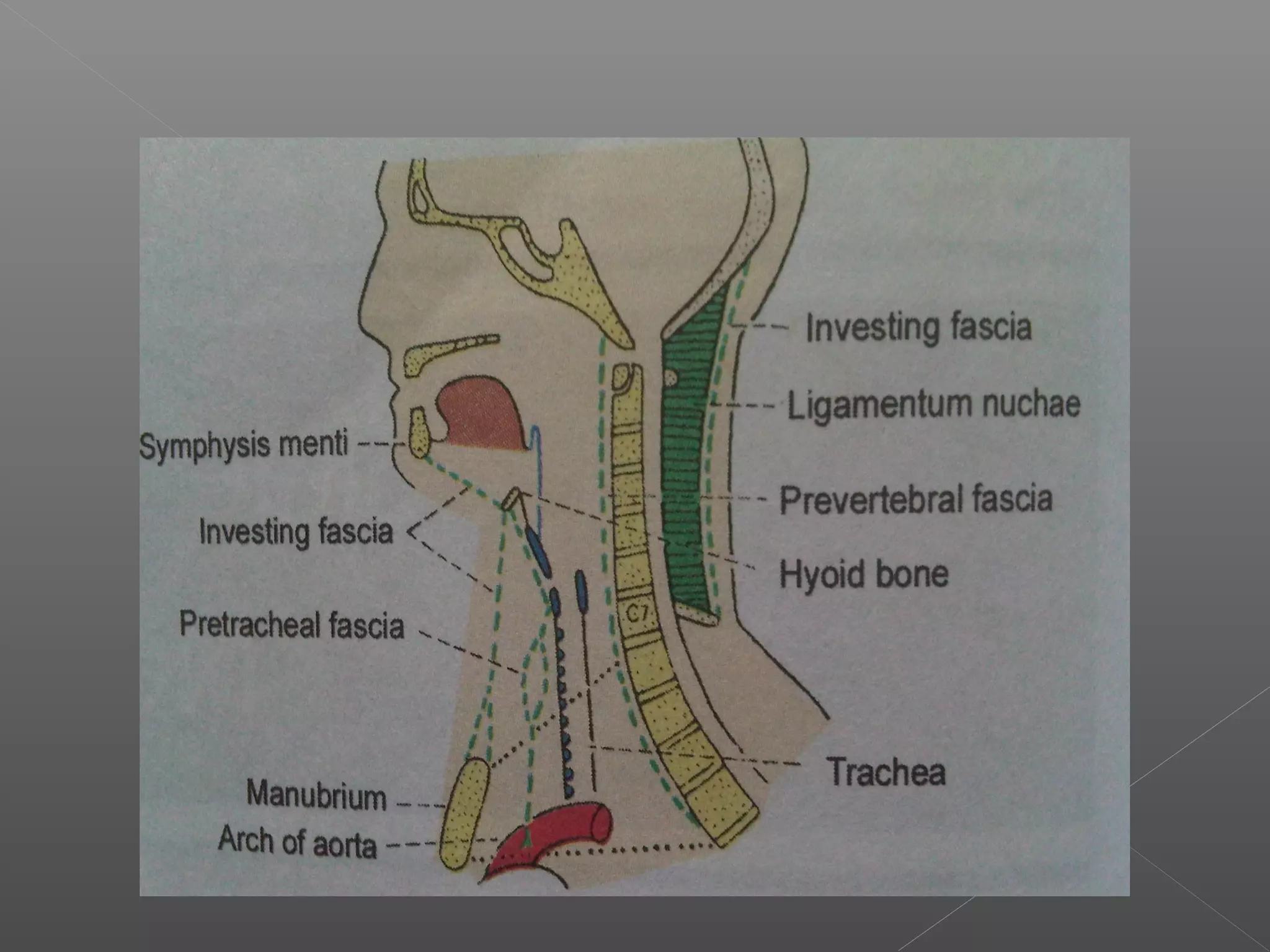 Neck dissections | PPT