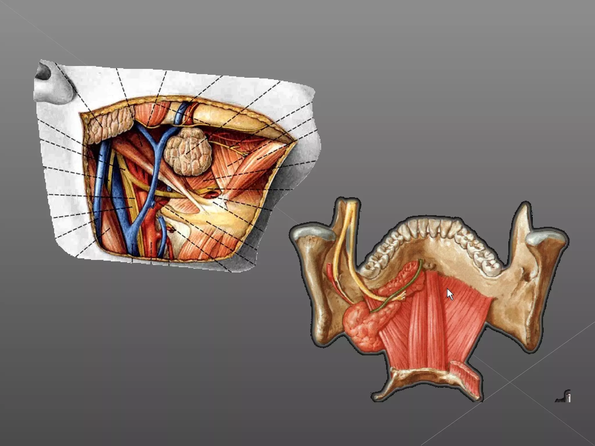 Neck dissections | PPT