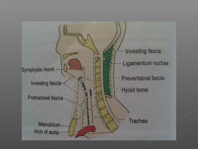 Neck dissections | PPT