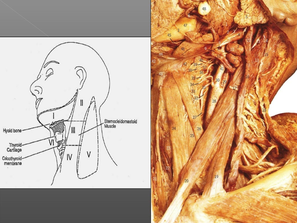 Neck dissections