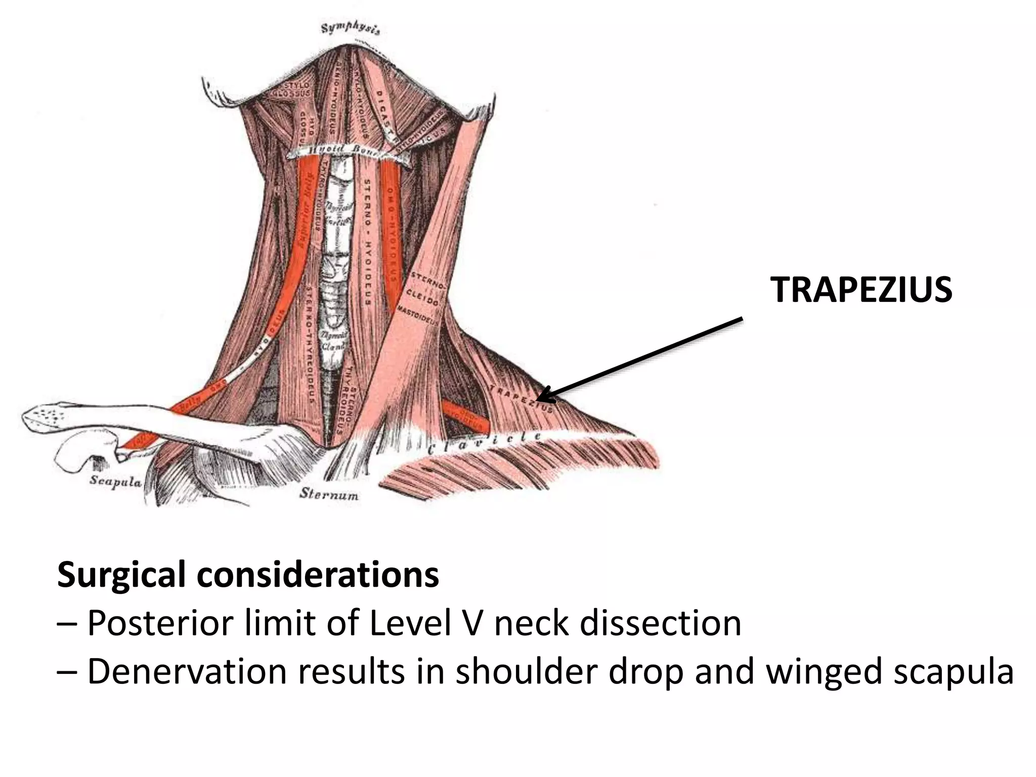 Neck dissections | PPTX