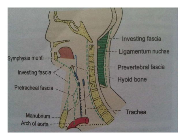 Neck dissections | PPTX | Death, Injury, or Military Conflict ...