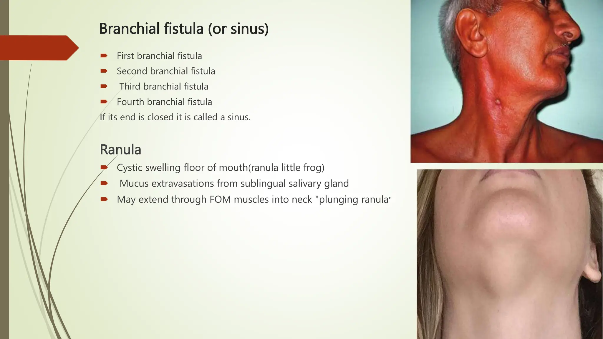 neck exam.pptx cervical lymph node examination | PPTX