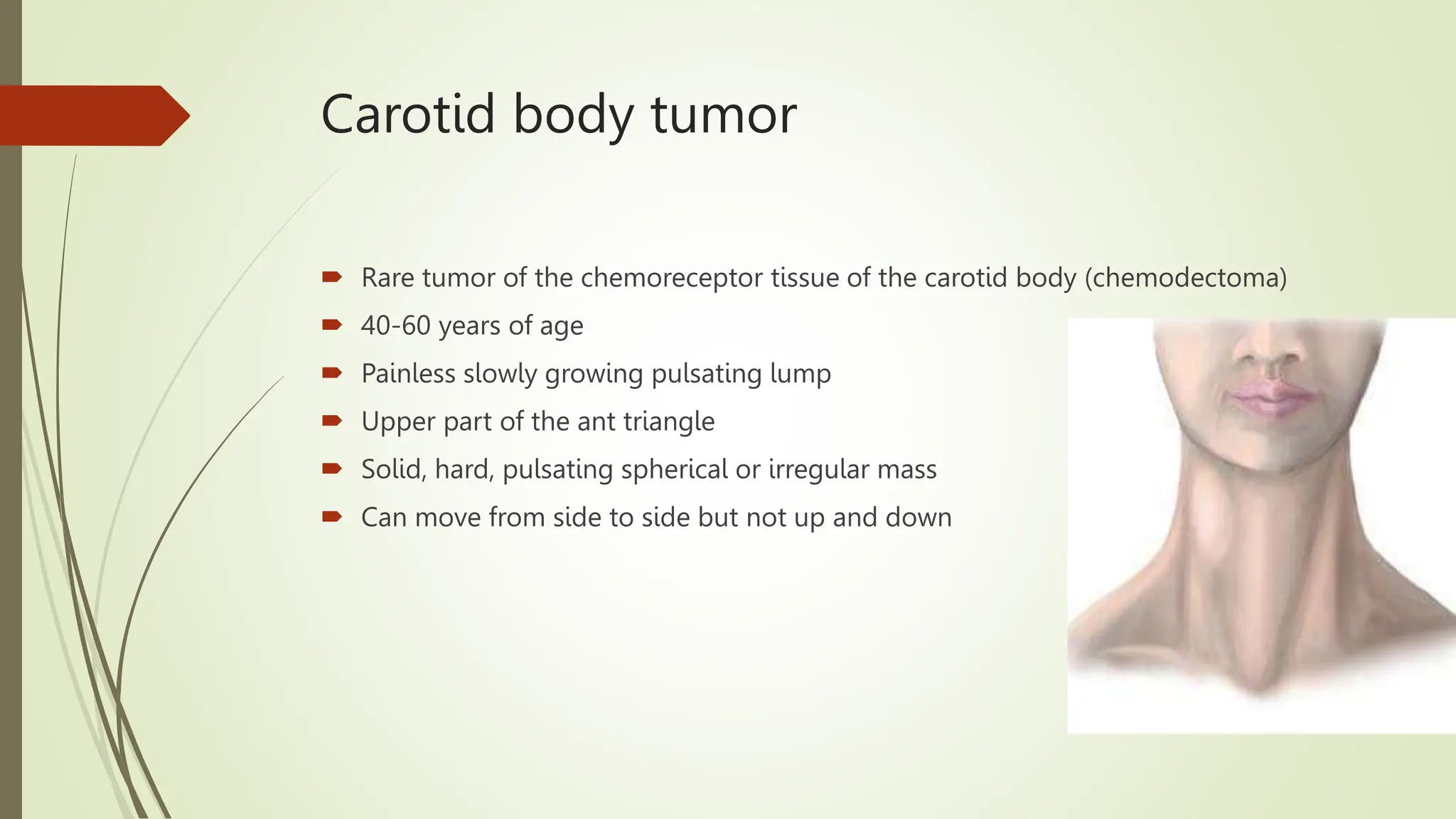 neck exam.pptx cervical lymph node examination | PPTX