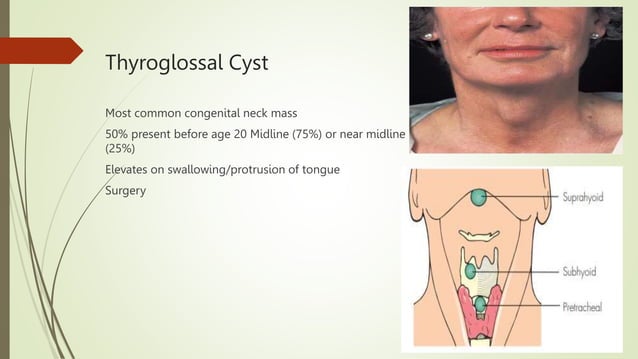 Neck Exampptx Cervical Lymph Node Examination Pptx 3794