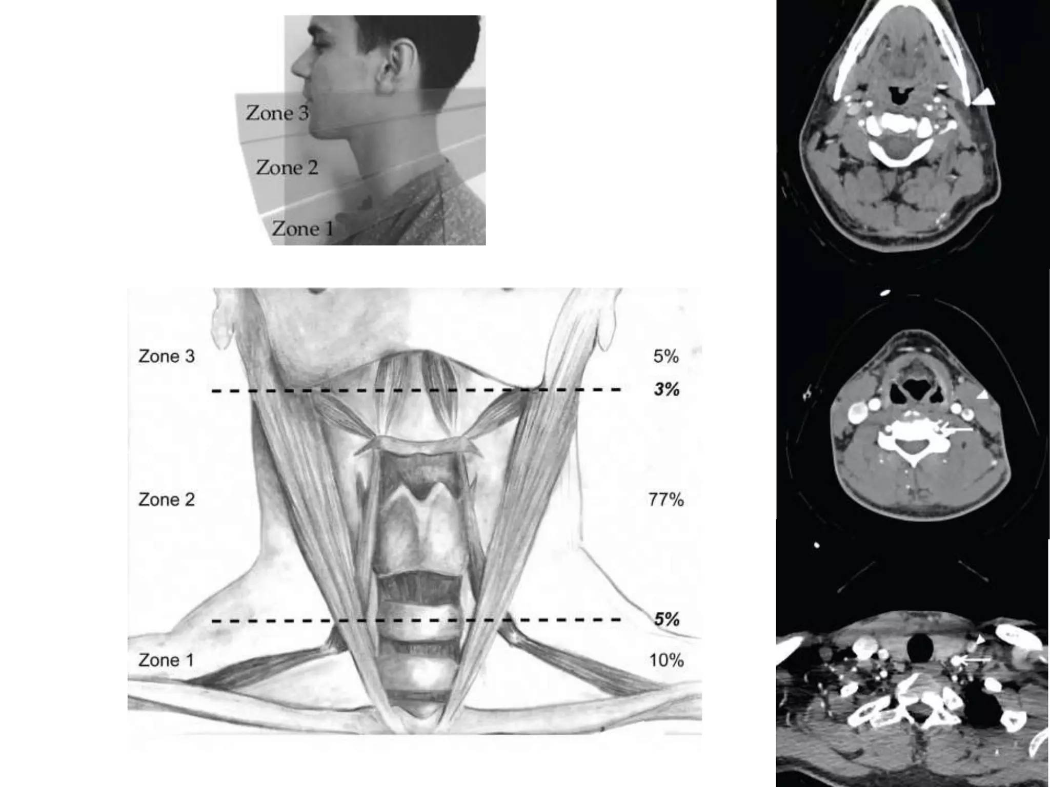 Neck & Facial trauma | PPTX