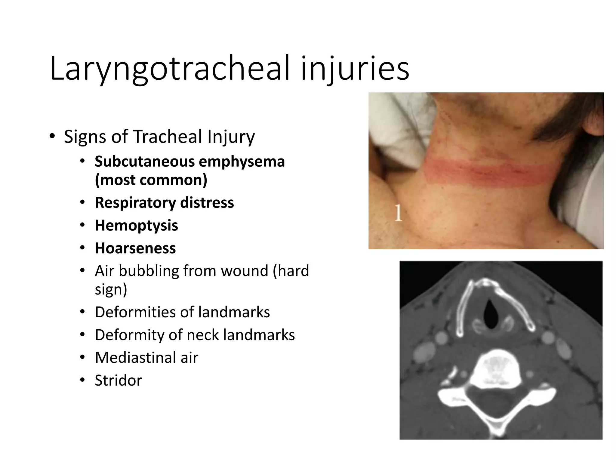 Neck & Facial trauma | PPTX