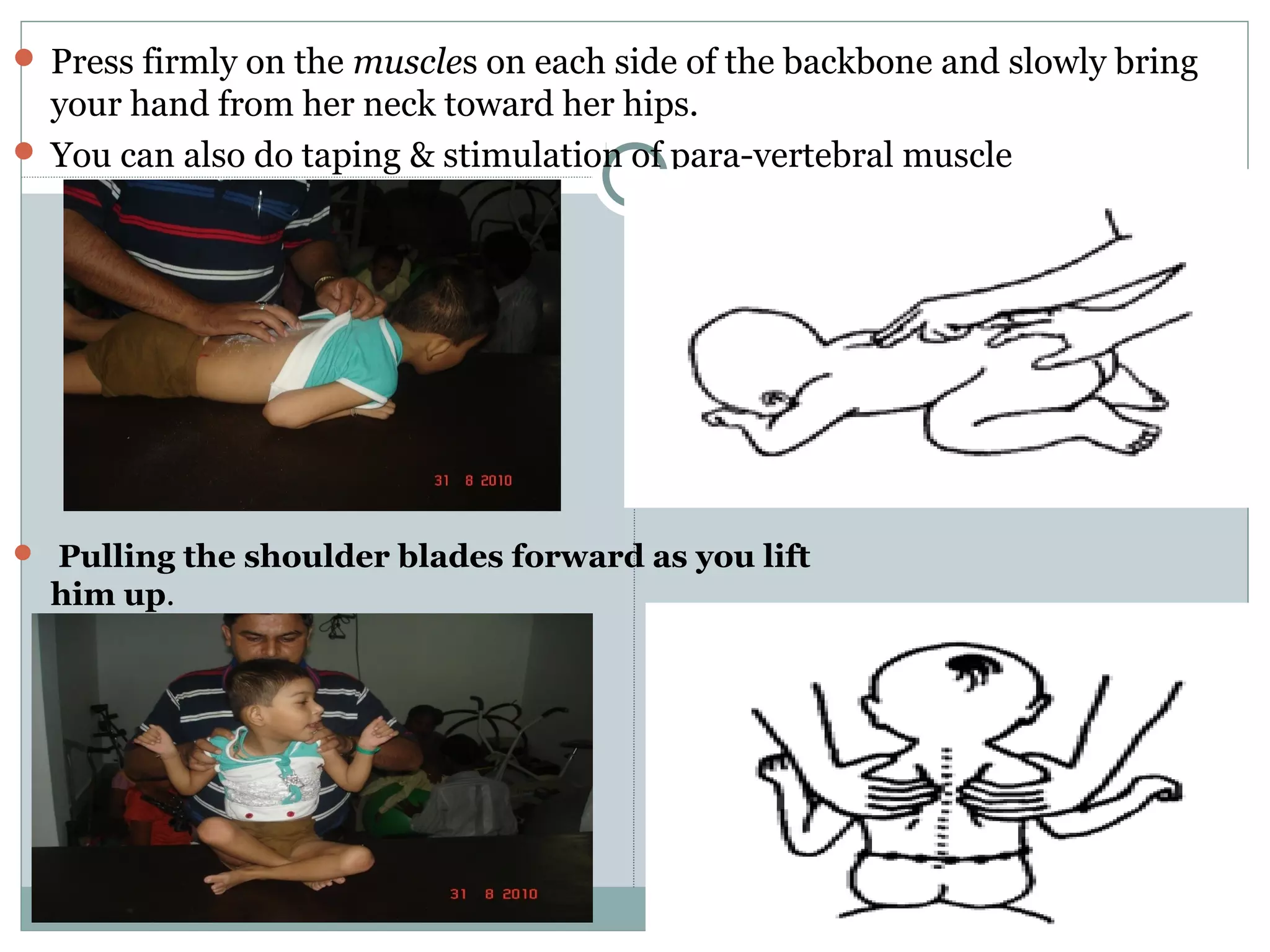 Therapeutic Technique to improve neck holding in cerebral palsy | PPT