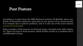 Neck Hump Causes | PPTX