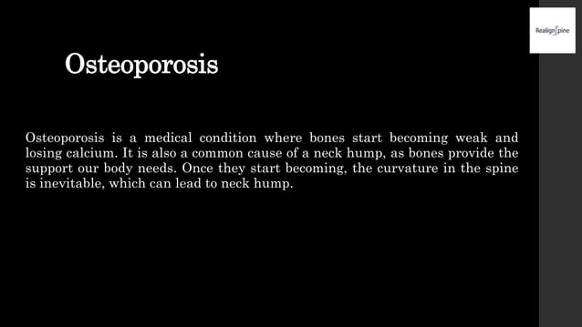 Neck Hump Causes | PPTX | Bone and Joint Conditions | Diseases and ...