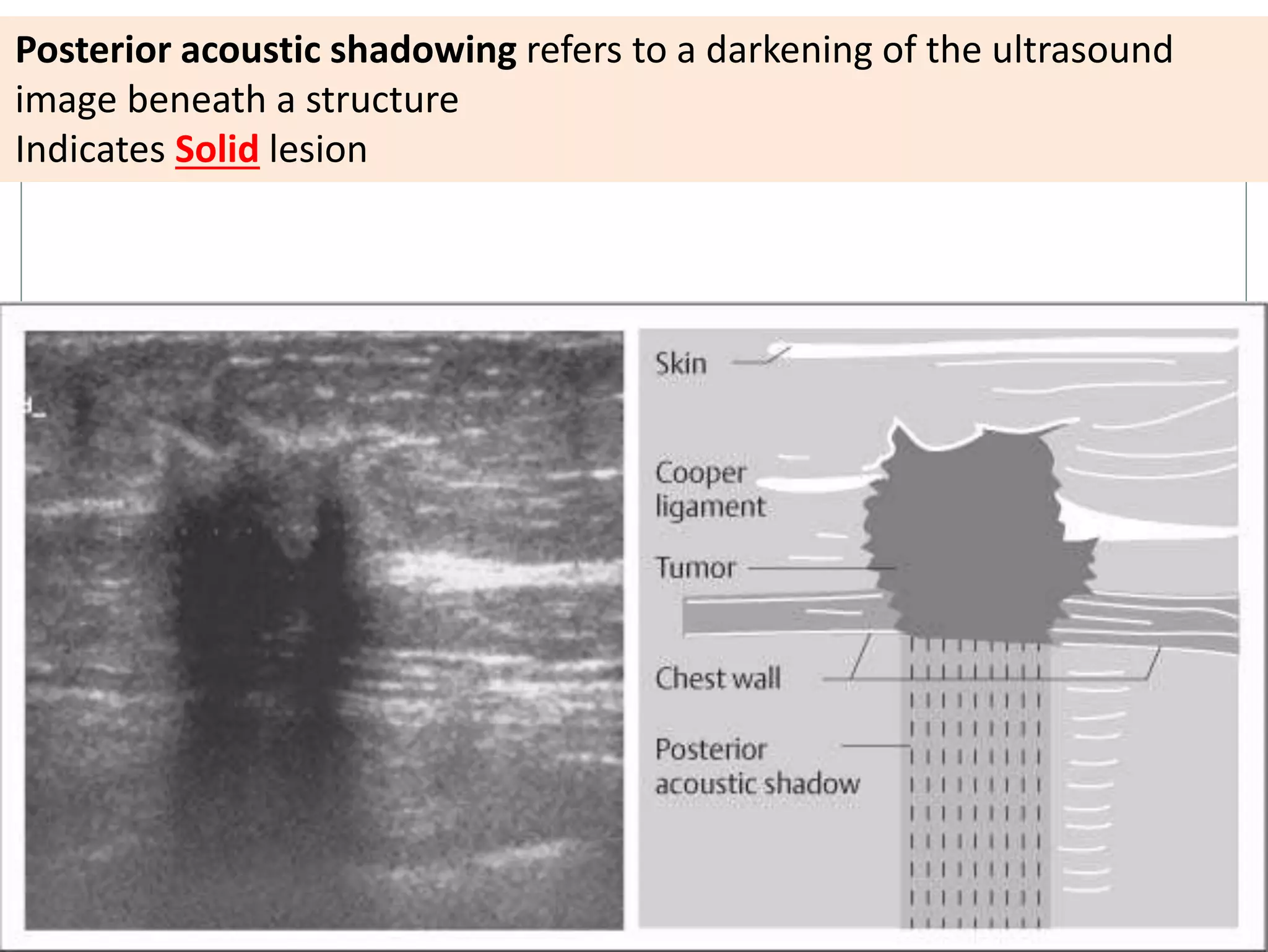 Neck Imaging.pptx