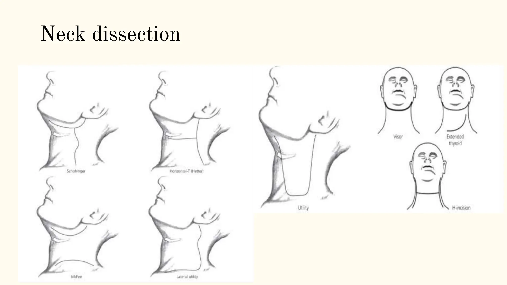 Neck incisions.pptx | Thyroid Disorders | Endocrine and Metabolic Diseases