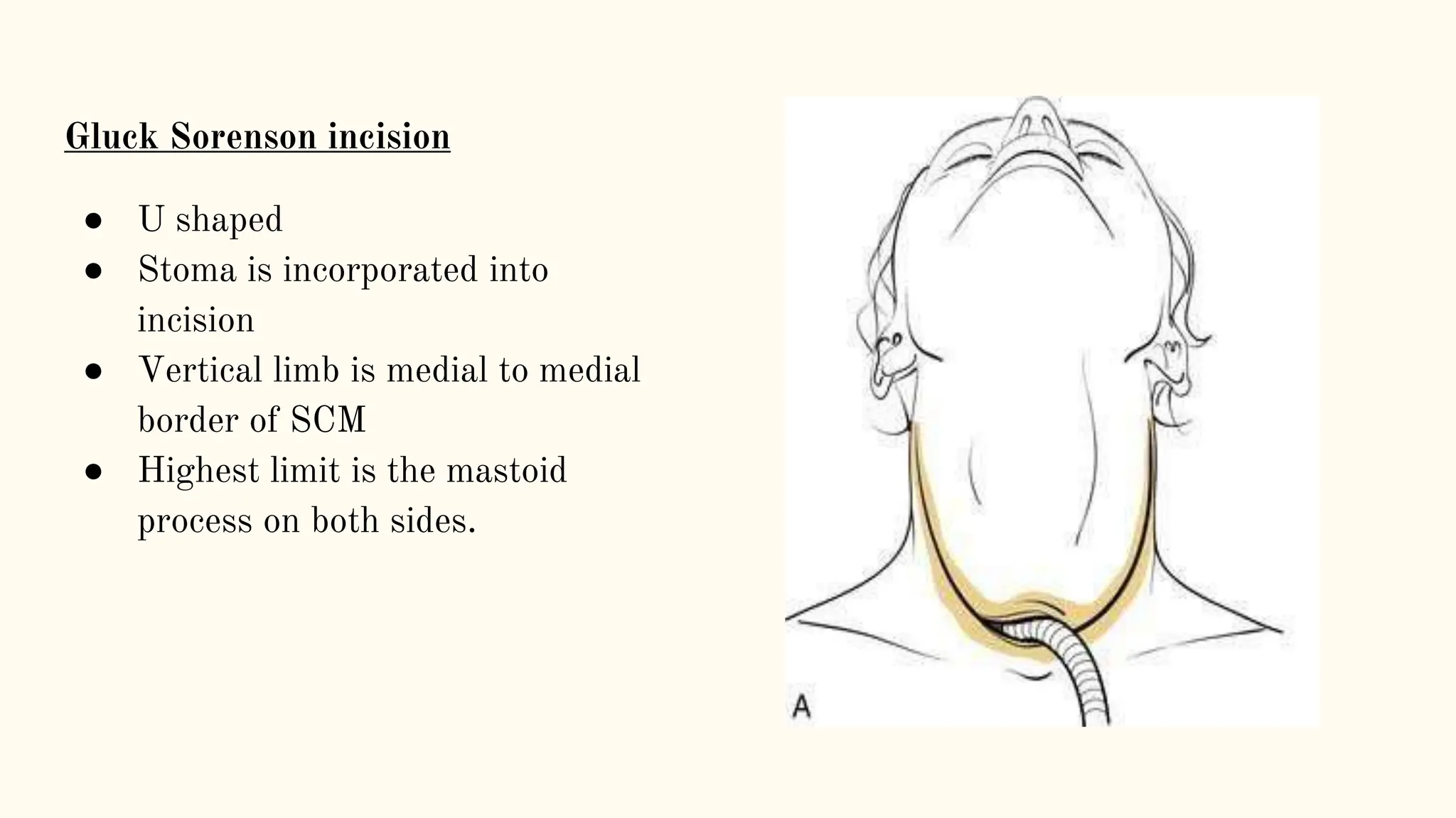 Neck incisions.pptx