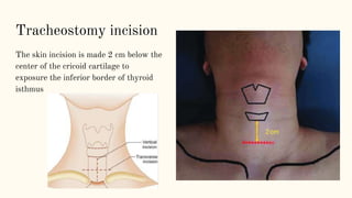 Neck incisions.pptx | Thyroid Disorders | Endocrine and Metabolic Diseases