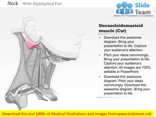 Neck lateral view medical images for power point | PDF