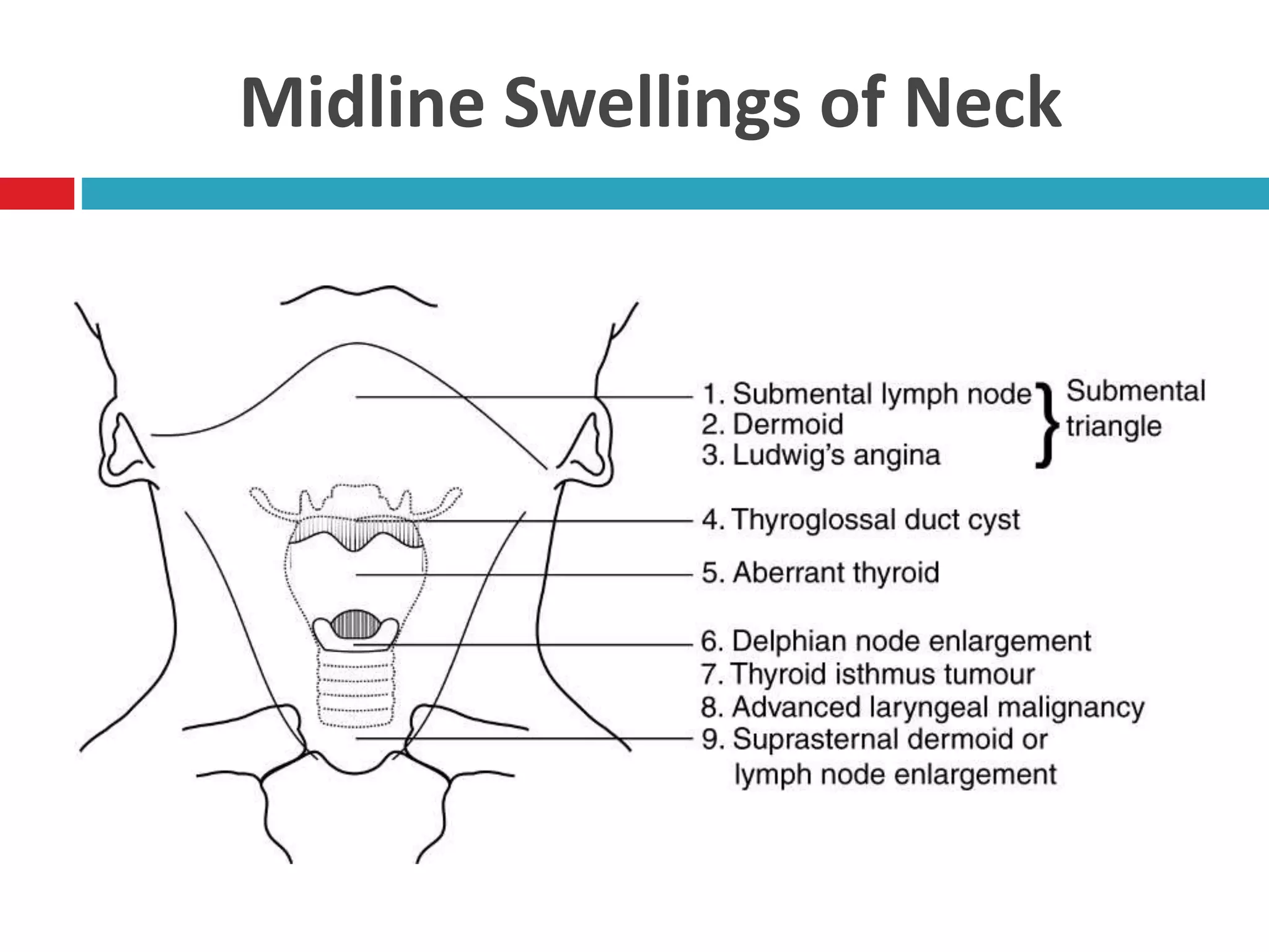 Neck Lump - A Case of Nodular Goitre | PPTX