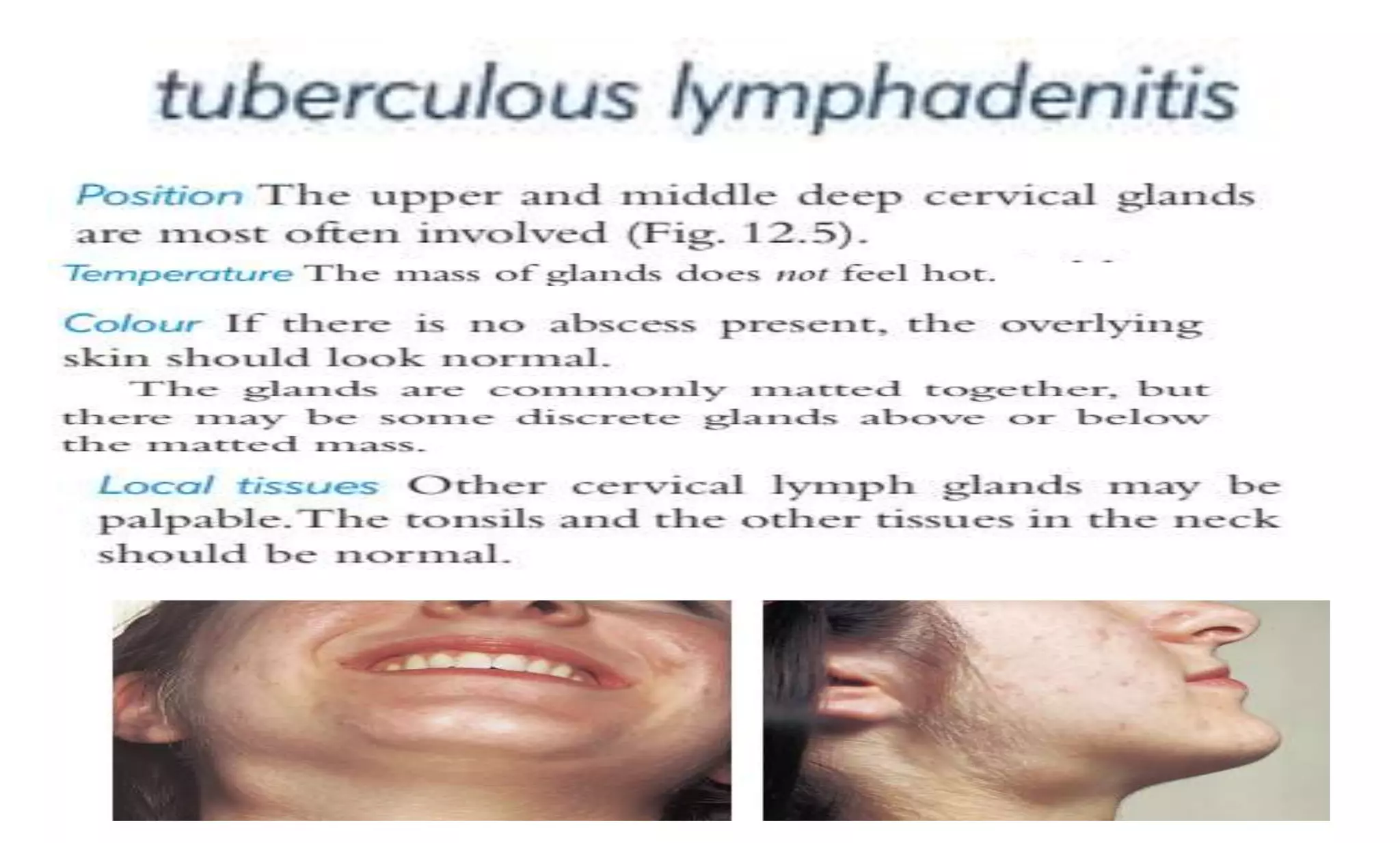 Neck mass approach | PPTX