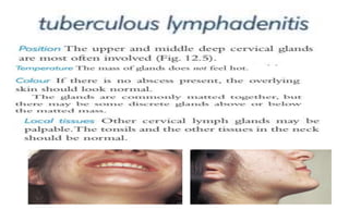 Neck Mass Approach Ppt