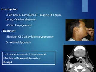 Lateral Neck mass 1.10.18