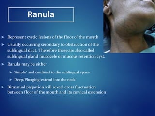 Lateral Neck mass 1.10.18