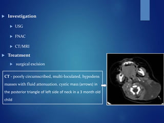 Lateral Neck mass 1.10.18