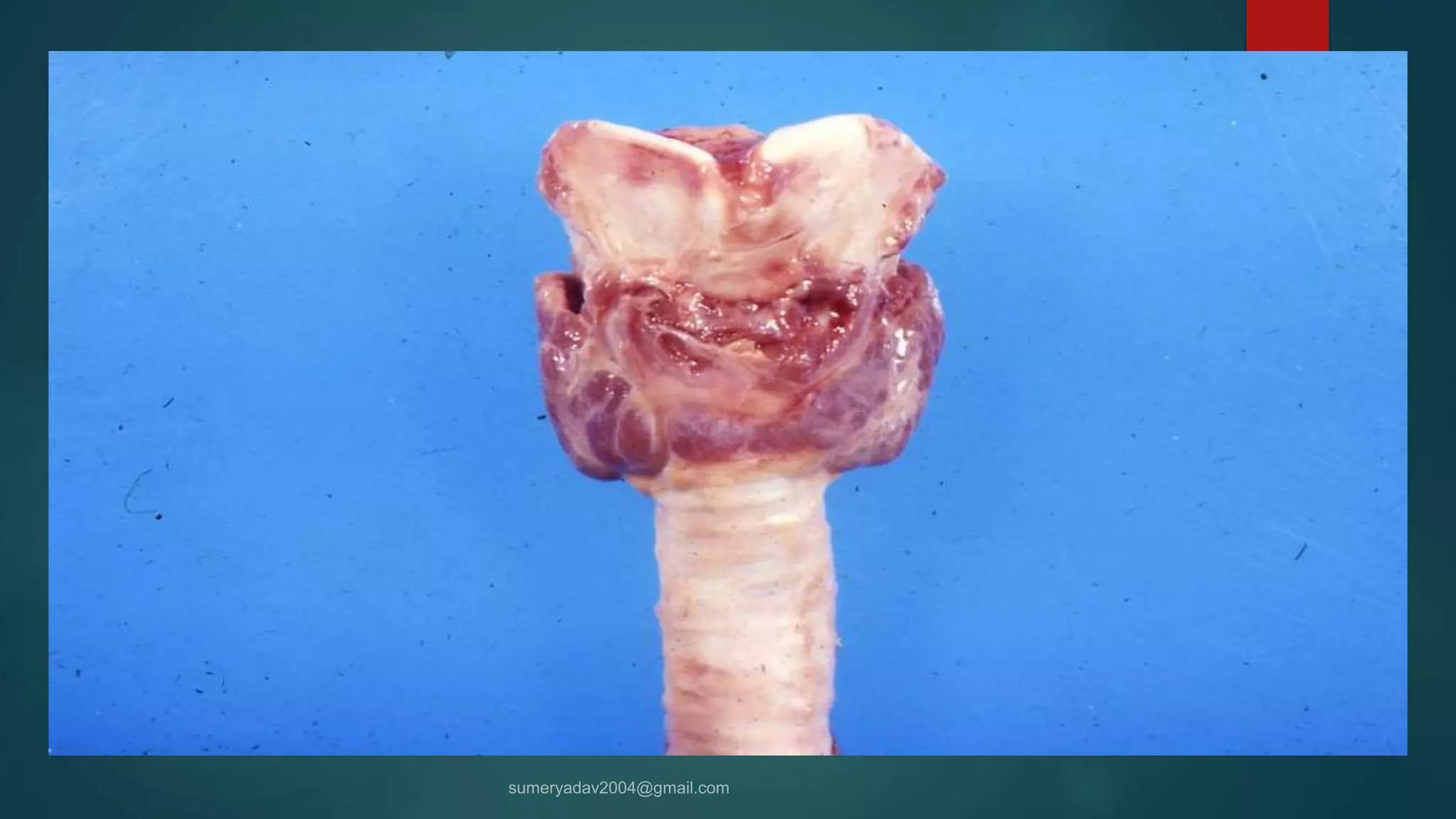 Neck Mass Differential Diagnosis Ppt
