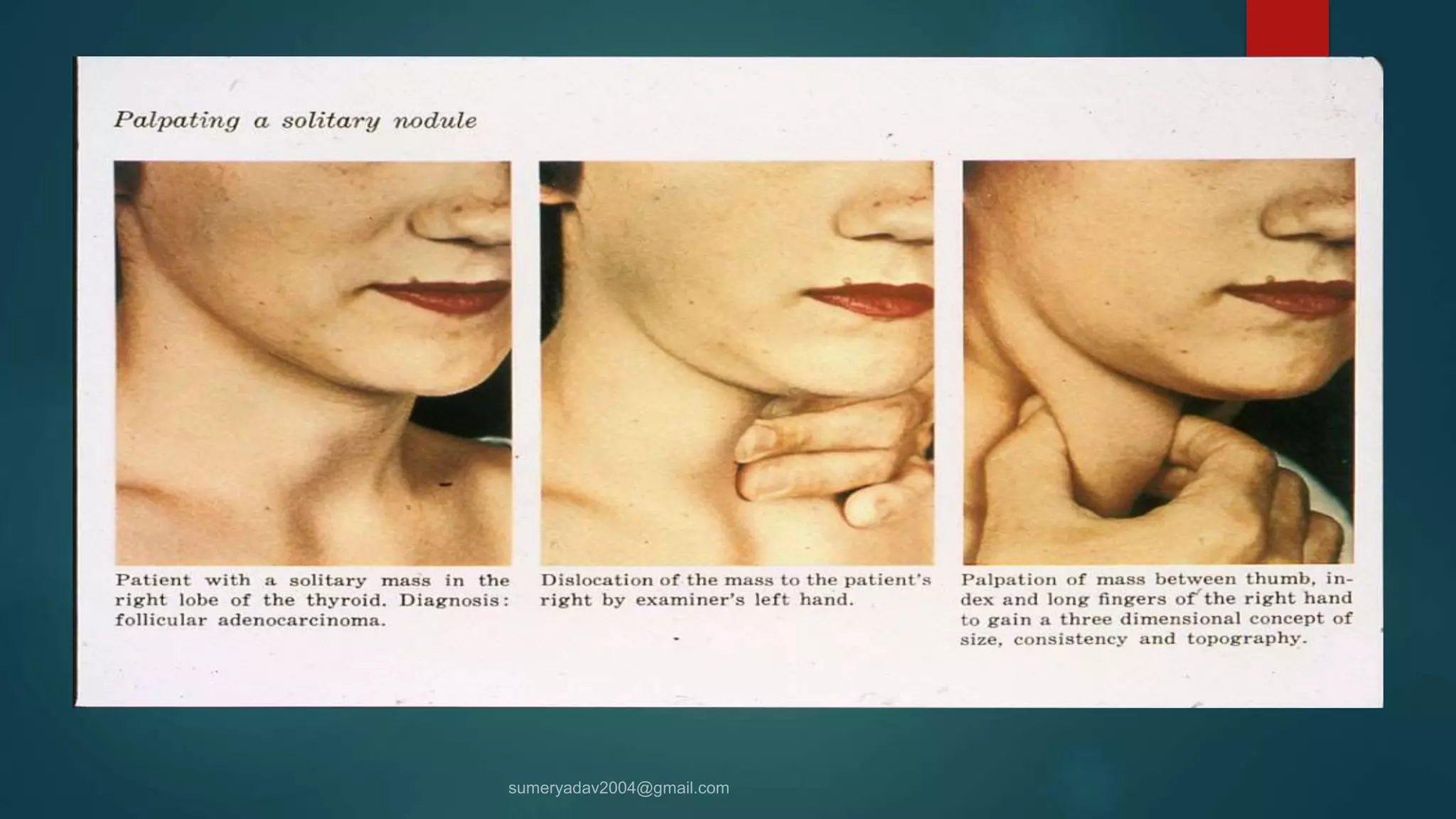 Neck mass differential diagnosis | PPTX