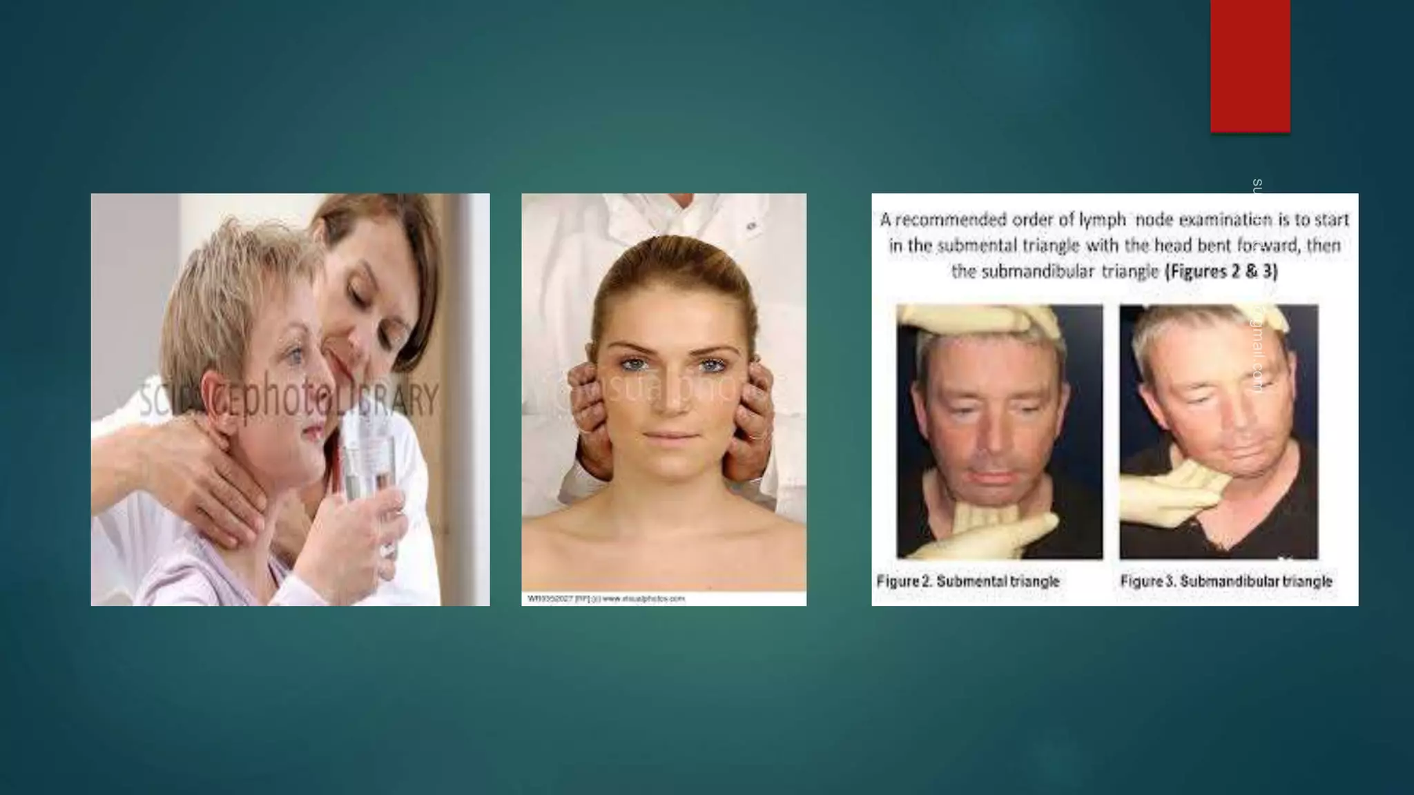 Neck mass differential diagnosis | PPTX