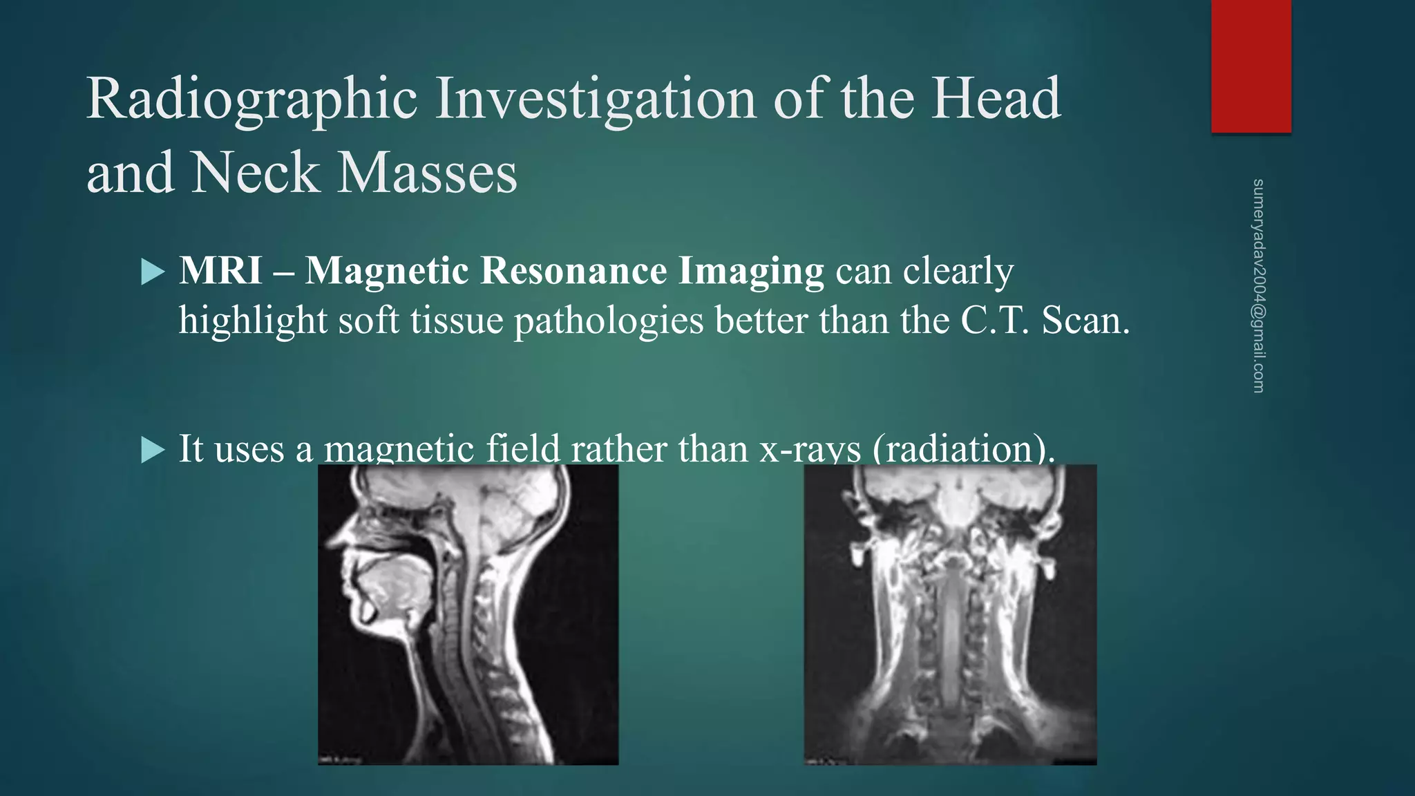 Neck mass differential diagnosis | PPTX